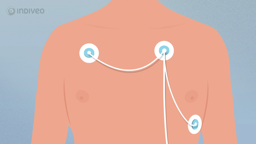 Polygrafie - Indiveo