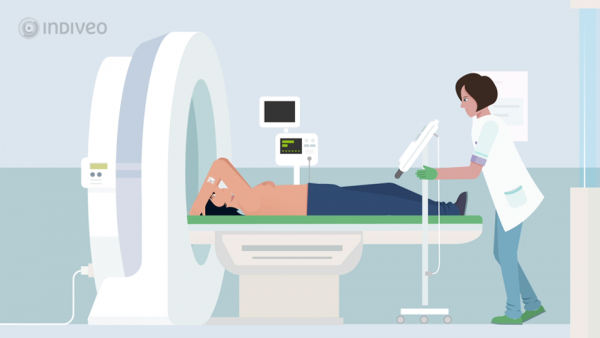 Myocardperfusie scintigrafie - Indiveo