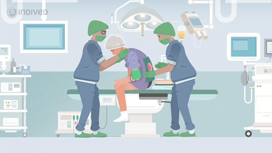 Epidurale verdoving (ruggenprik) - Indiveo