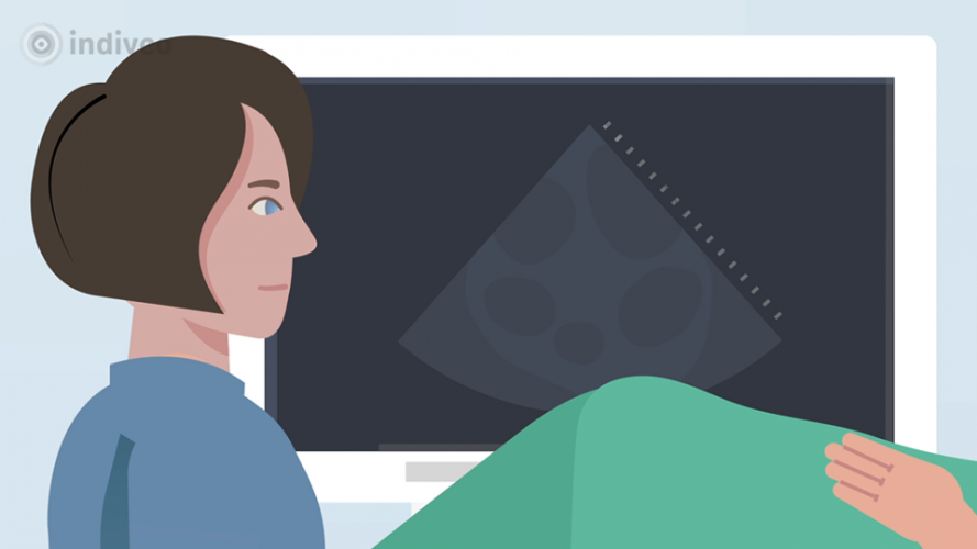 Follikelpunctie - Indiveo