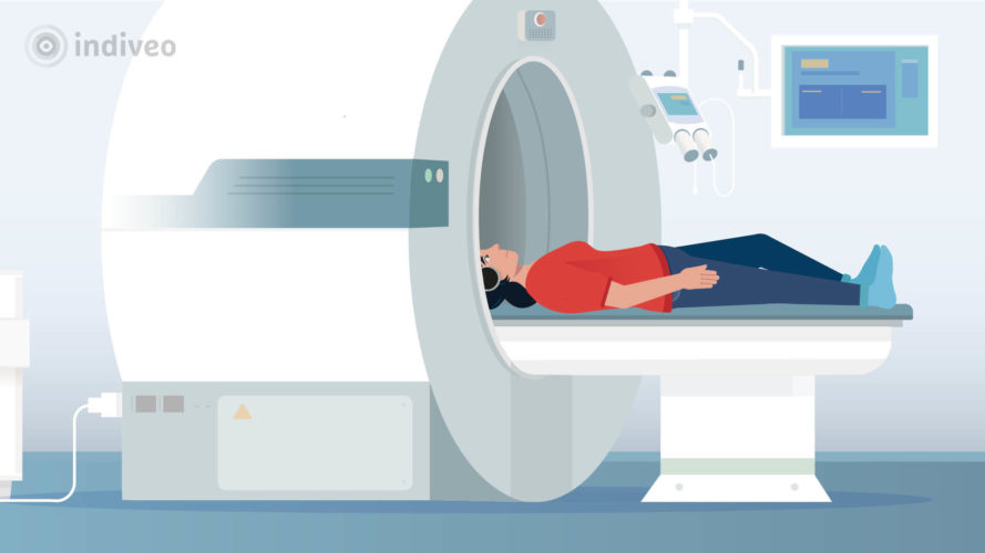 Myocardperfusie scintigrafie - Indiveo