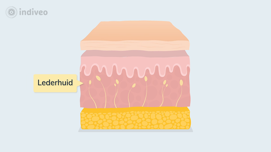 Atopisch eczeem - Indiveo