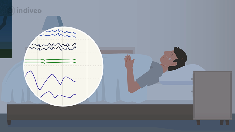 Polygrafie Nox T3 - Indiveo
