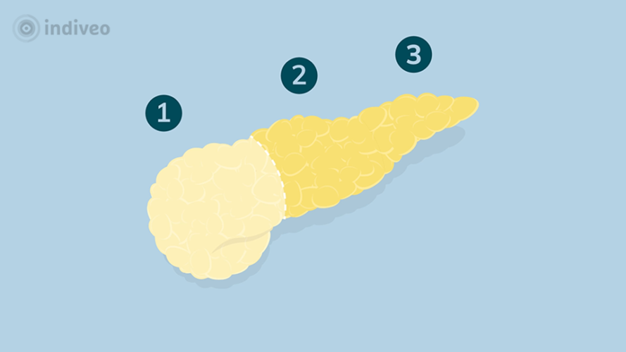 Operatie aan de alvleesklier (PPPD en Whipple) - Indiveo